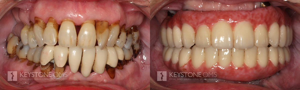 Photo Galleries | Keystone OMS