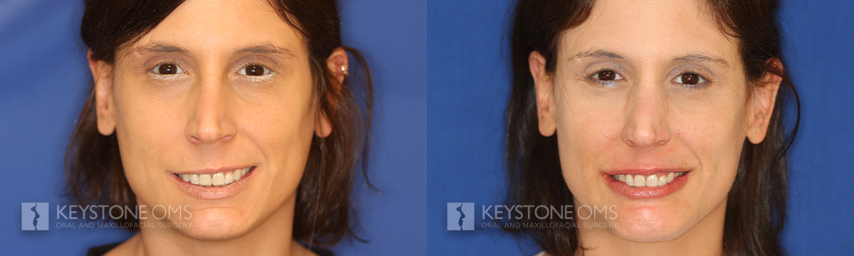 Photo Galleries | Keystone OMS