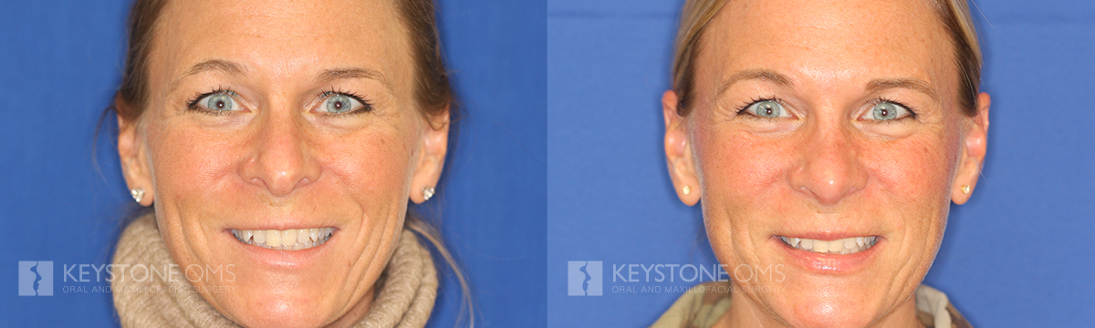 Photo Galleries | Keystone OMS